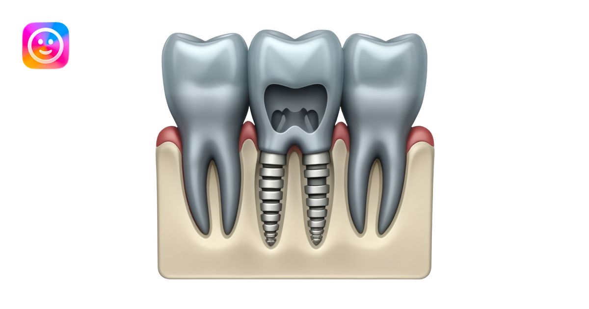 3D render of Dental X-Ray, X-Ray imaging aesthetic, translucent ...